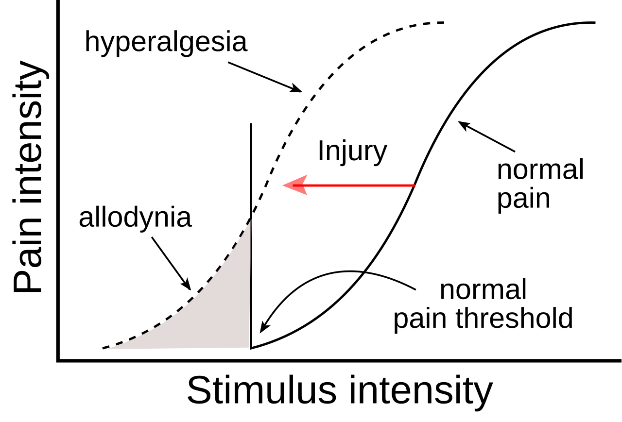 When Your Nerves Get Trigger-Happy: Understanding Peripheral ...
